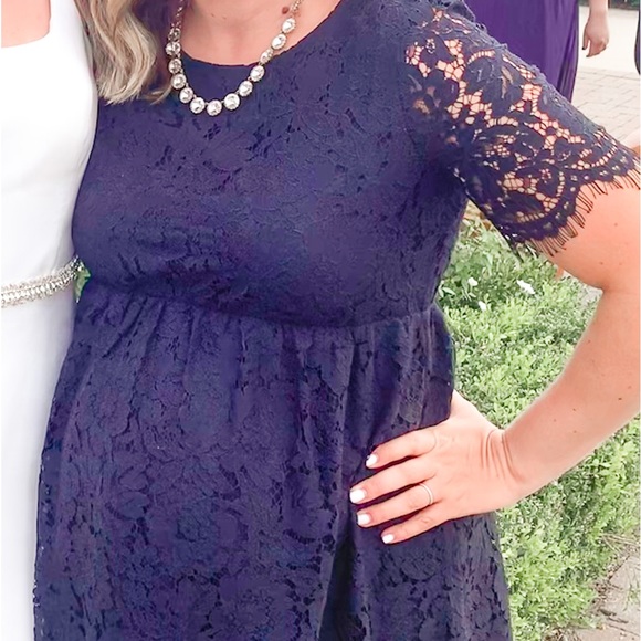 GAP | Dresses | Maternity Lace Black Dress | Poshmark